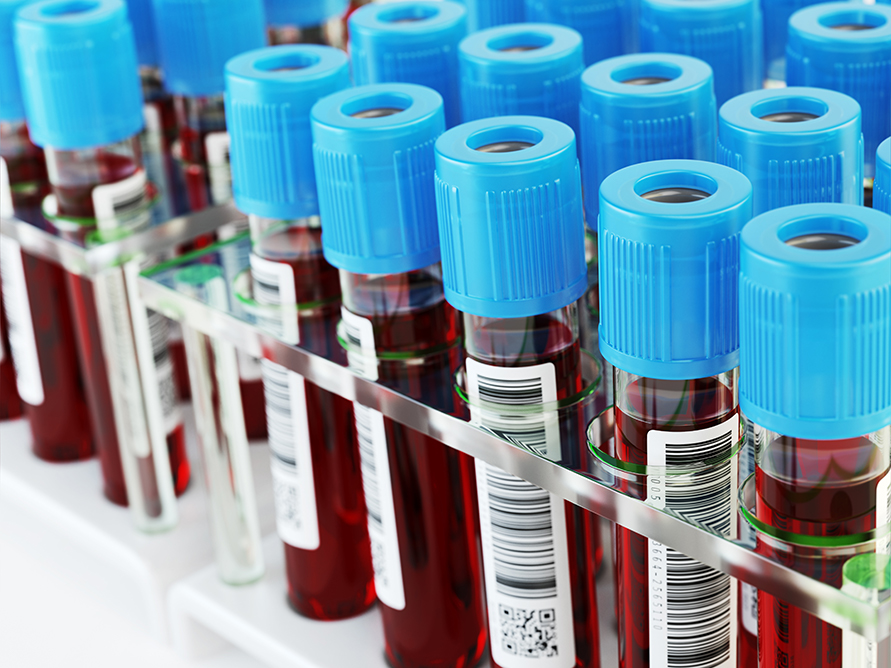 Preturi & Servicii Analize medicale - Clinica Exmed Malcoci